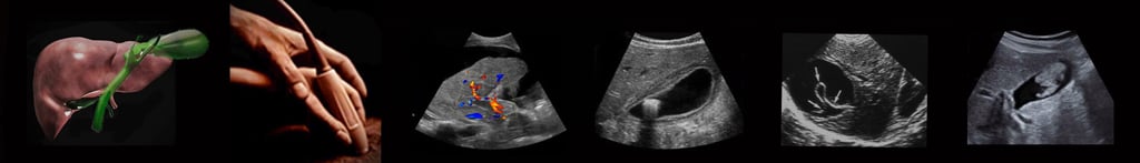 Hands-On Abdominal Ultrasound Training | Clinical Scanning | Keith ...