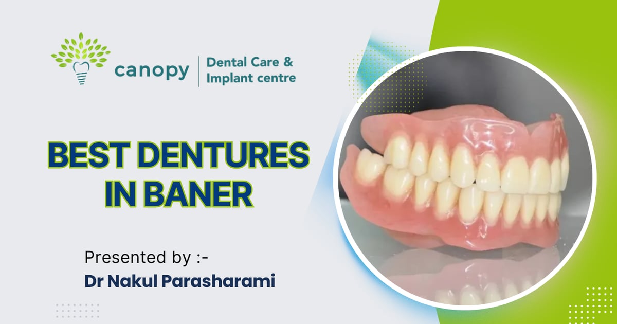 Dentures clinic in Baner | Best Dentures in Baner | Dentist