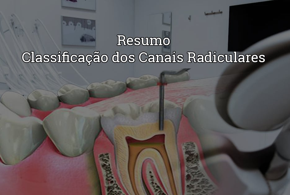Classificação dos Canais Radiculares - Resumo | Odontologia com André