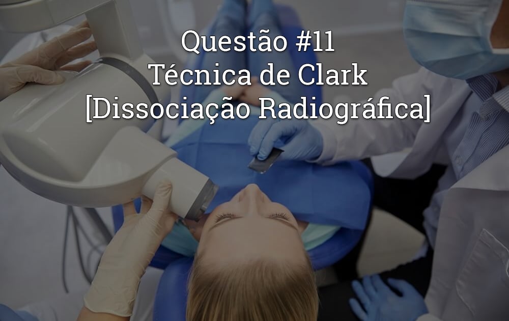 Técnica de Clark - Dissociação Radiográfica em Odontologia ...