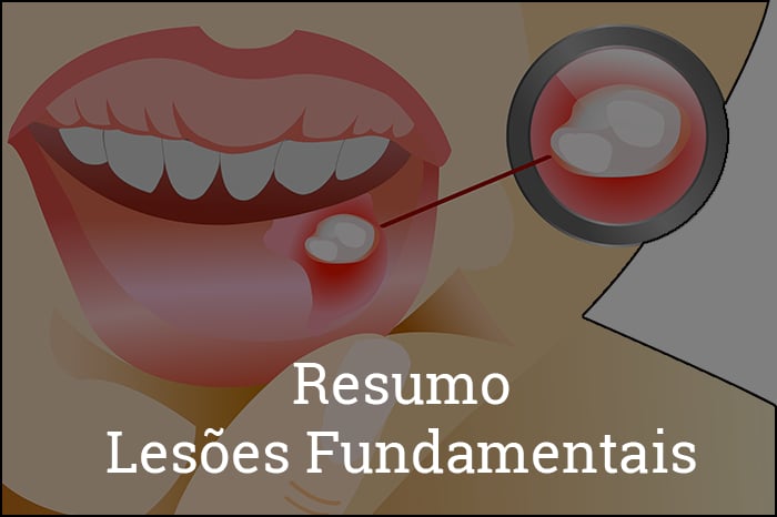 Lesões Fundamentais em Odontologia | Odontologia com André