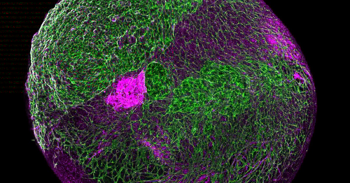 Cerebro Machines Lab - Pioneers in Biomimetic Drug Delivery ...