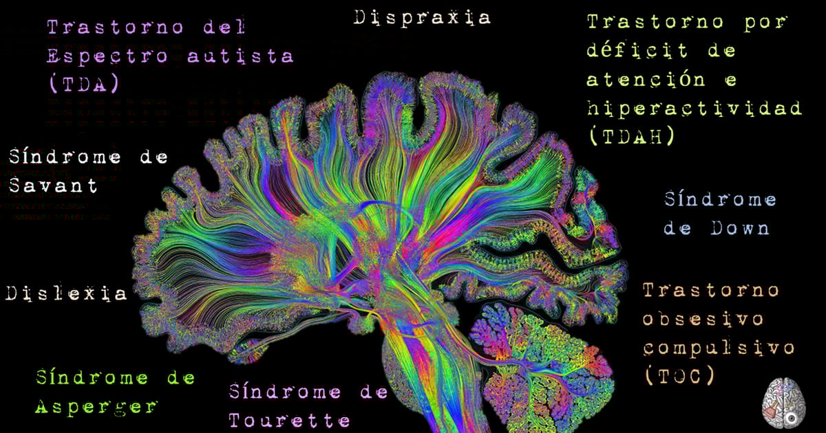 Neurodiversidad: No todos los cerebros son idénticos | La Célula de ...