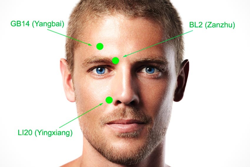 The Necessity of Acupuncture in the Treatment of Facial Paralysis: A ...