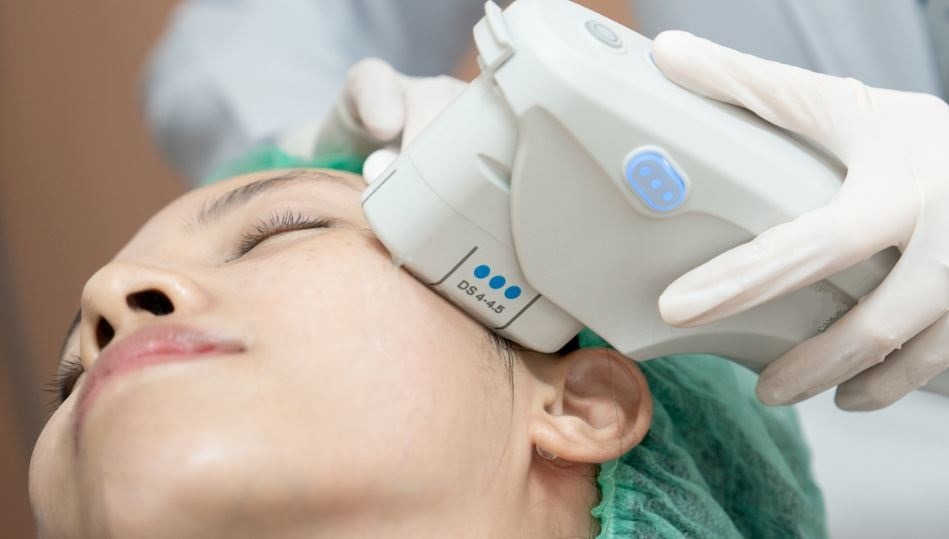 Ultraformer MPT HIFU | Non-Surgical Face Lift | White Aesthetics ...