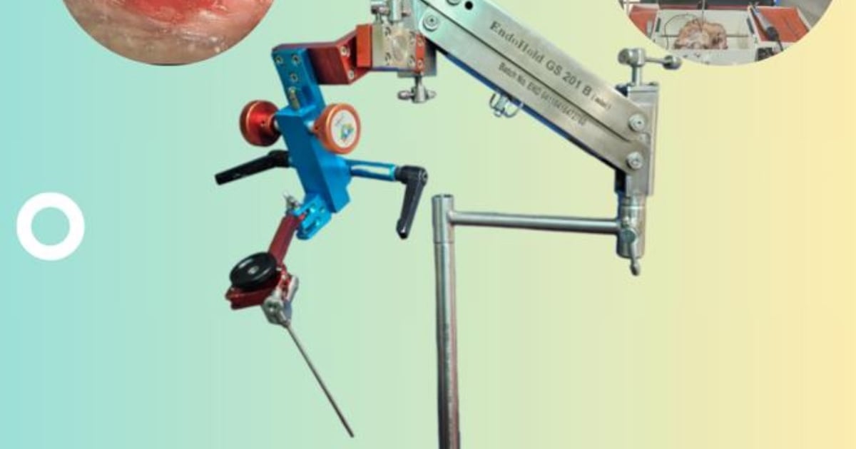 Endoscope Holder for Minimal Invasive ENT Surgeries | Innovation |. Dr ...