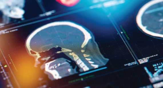 Game-Changing X-Ray Innovations in Medical Imaging | Xray News