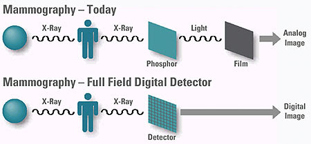 The Evolution of X-ray Imaging: From Film to Digital | Xray News