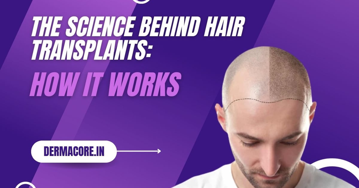 The Science Behind Hair Transplants: How It Works | Dermacore