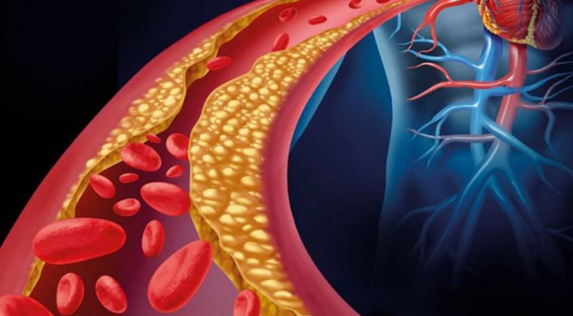 🧐 Colesterol: Lo que debes saber | Dr Caroli cardiólogo