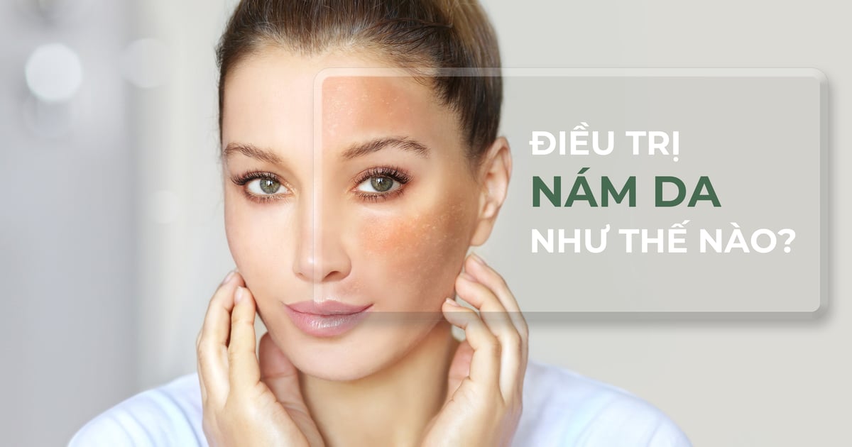 Cách Chống Nắng và Trị Nám Hiệu Quả Để Ngăn Ngừa Nám Quay Trở Lại ...