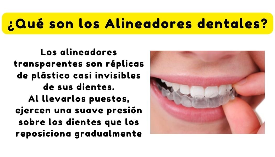 Alineadores dentales: una solución discreta para corregir la posición ...