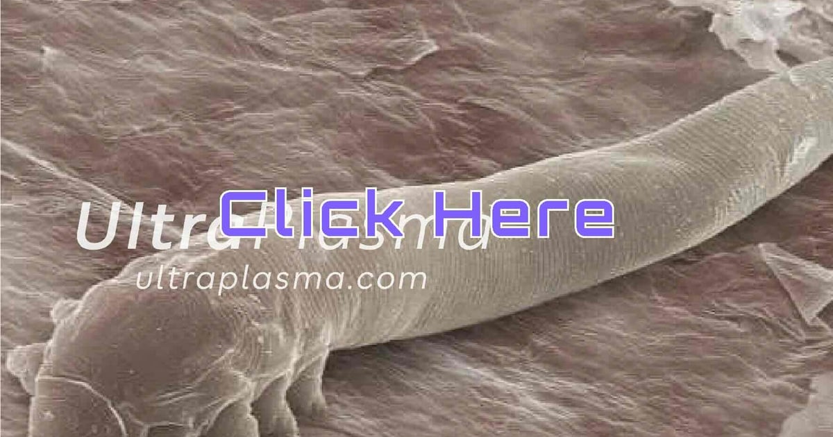 UltraPlasma™ Demodex (folliculorum - brevis) | UltraPlasma™ Human ...