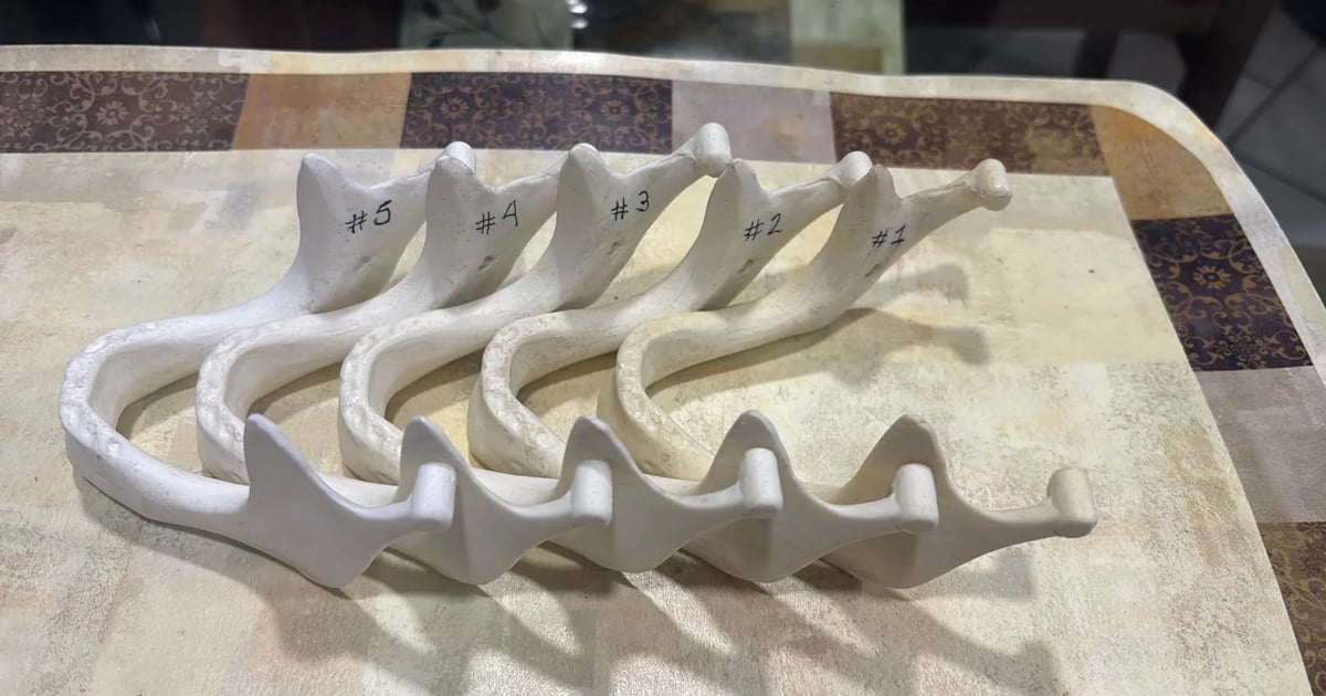 Five Bone Densities: The Future of 3D Mandible Models | Clear Simulations