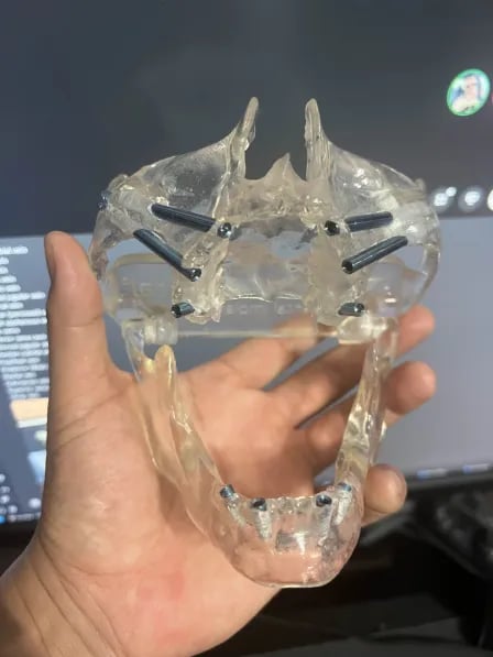 The Importance of 3D-Printed Dental Models for Pre-Operative Planning ...