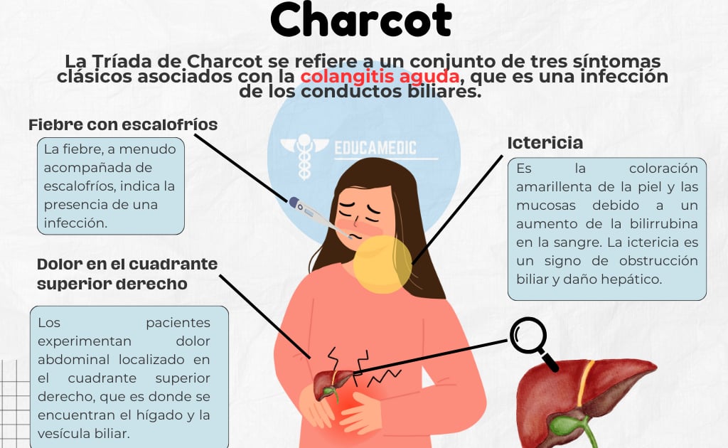 La Tríada de Charcot: Diagnóstico y Tratamiento de la Colangitis Aguda ...