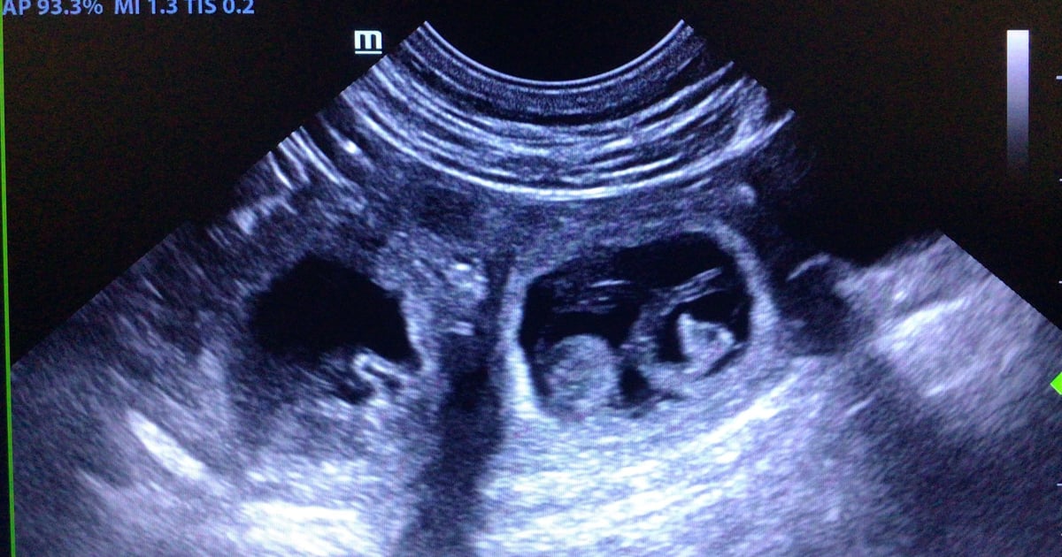 Boo's Pregnancy: A Time of Change | Bellamiscela Border Collies ...