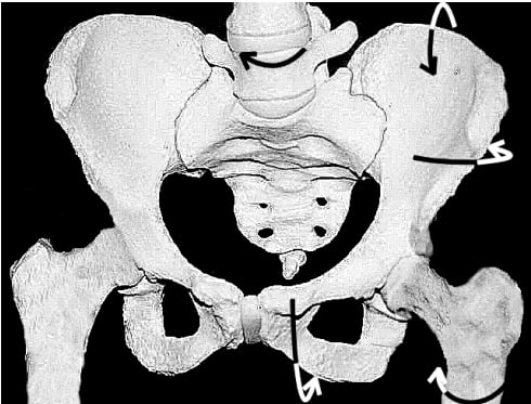 Is your Right Hip Higher Than the Left? | Body Conditioning