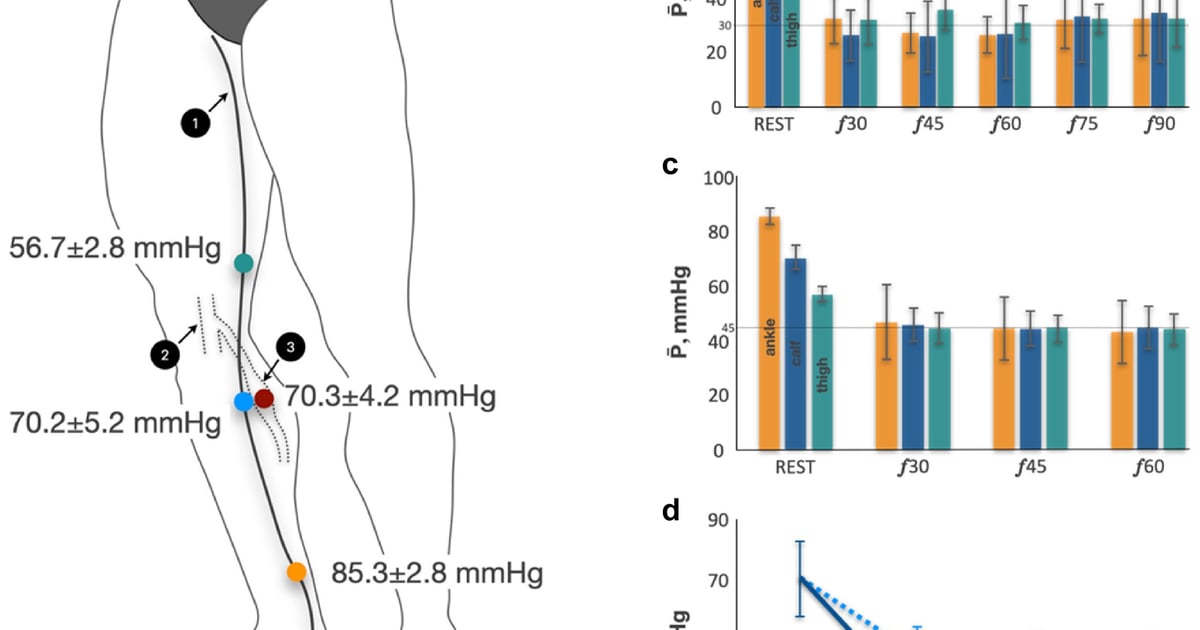 The Role of the Lower Leg Muscle Pump in Maintaining Venous Pressure ...