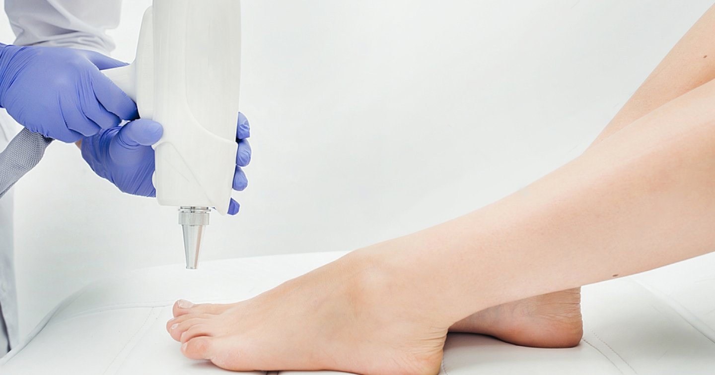 Hand and Toenail Fungus Removal at Kuzmar Clinic | Kuzmar Clinic