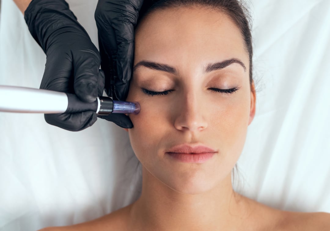 Todo lo que alguna vez te preguntaste sobre el Dermapen | O.A. Clinic By Mariana Herrera