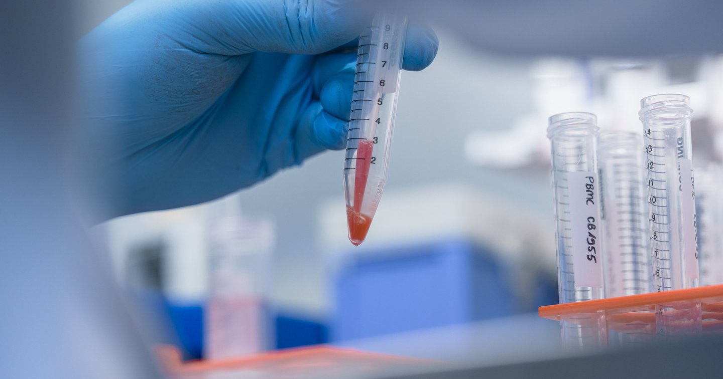 CTIBIOTECH Supports World Blood Donation Day | CTI Biotech