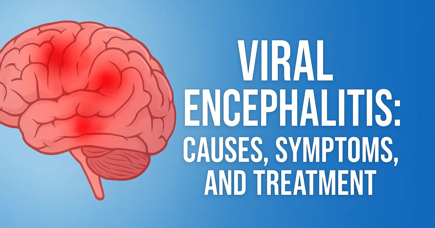 Viral Encephalitis: Causes, Symptoms, Diagnosis & Treatment | MicroNews