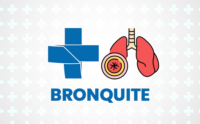 Bronquite: Diagnóstico e Tratamento pelo SUS | VIVA O SUS!