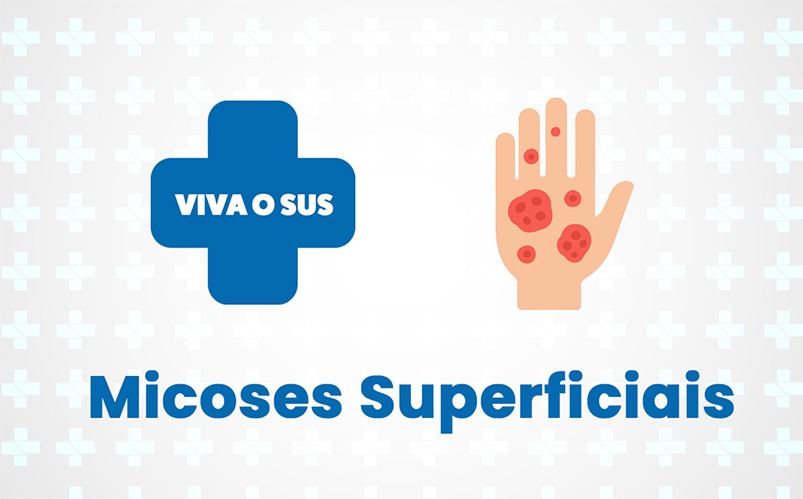Micoses Superficiais: Tipos, Fluxo de Atendimento, Acesso a ...