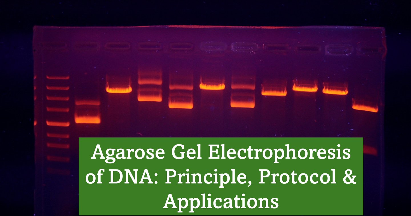 Agarose Gel Electrophoresis of DNA: Protocol, Results, and ...