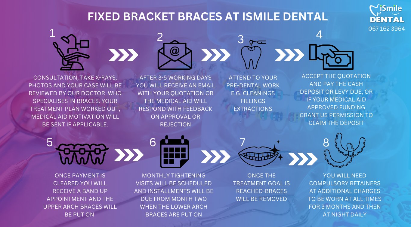 Fixed Bracket Braces A Comprehensive Guide to Getting Braces at iSmile Dental: Step-by-Step ...