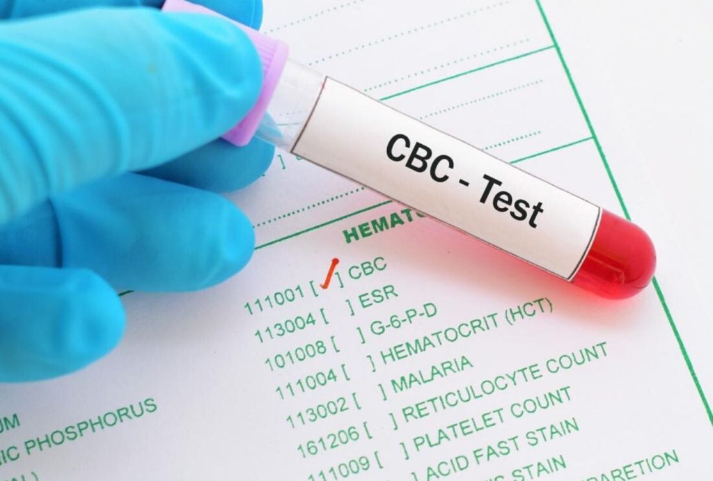 CBC Test: What It Is, Normal Ranges, and Why It Matters | Islamabad ...