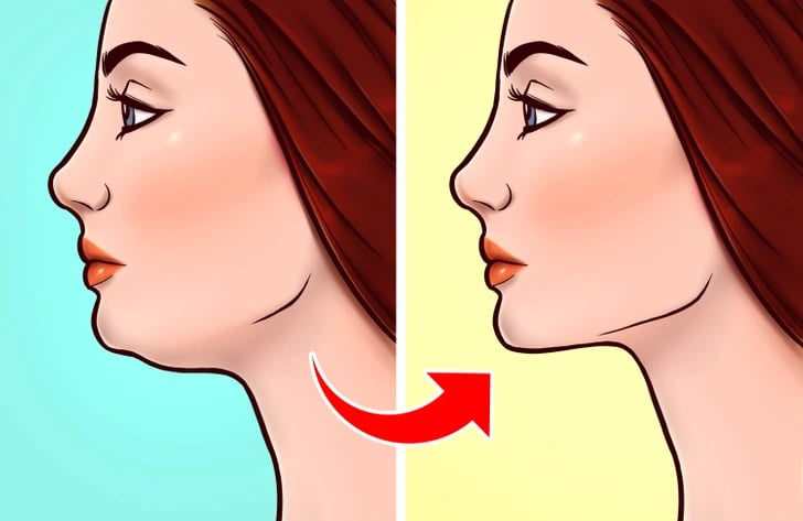 The Importance of Tongue Posture for Facial Appearance and Double Chin ...