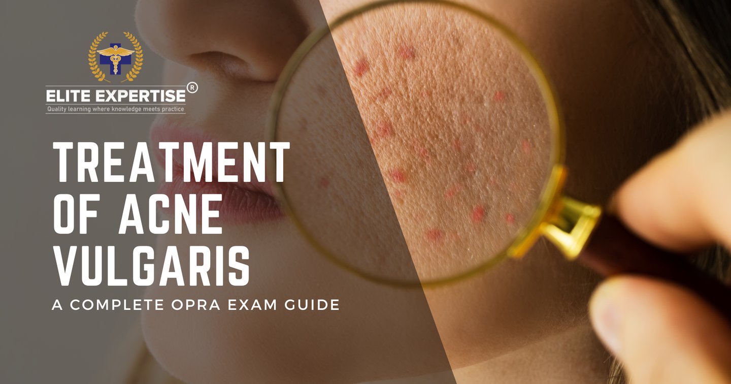 Treatment of Acne Vulgaris: A Complete OPRA Exam Guide | Elite Expertise