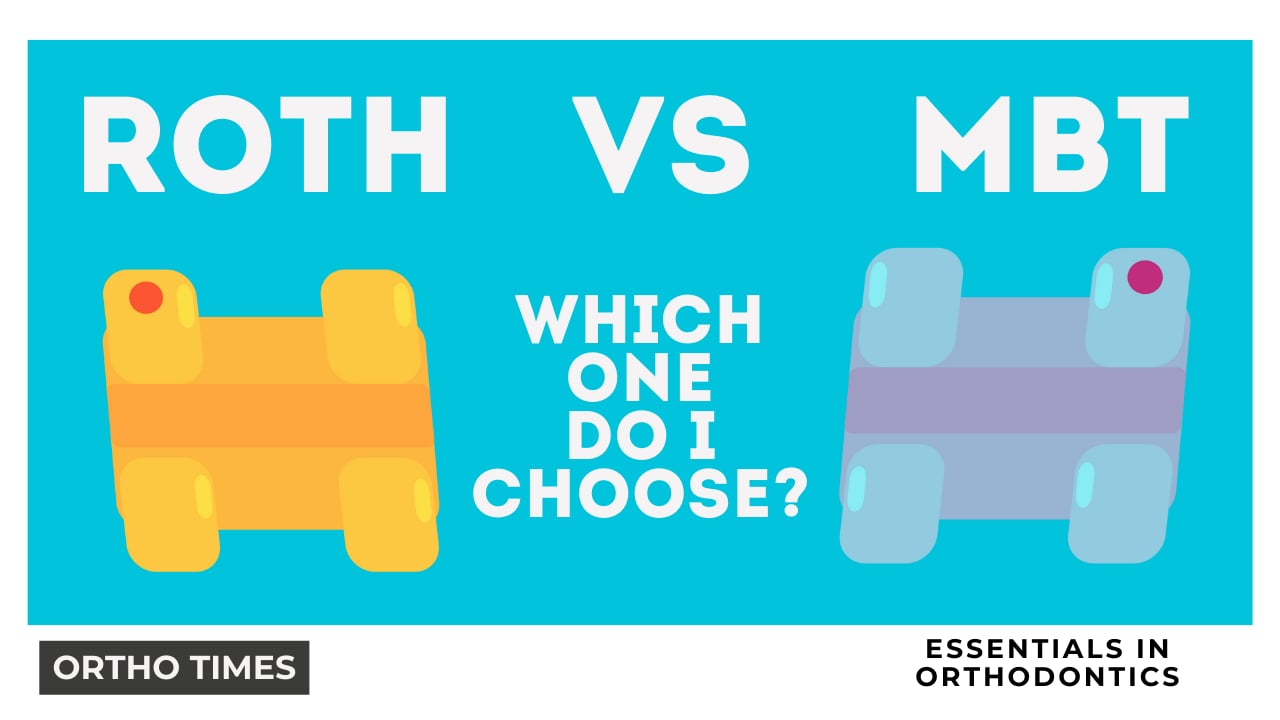 Roth Vs MBT Brackets- which one to choose ? | Ortho Times