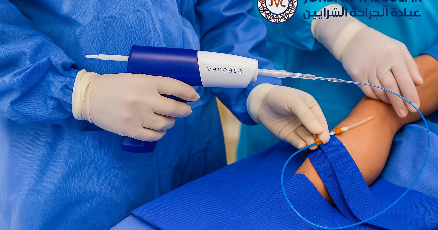VenaSeal™ Closure System | Jordan Vascular Clinic