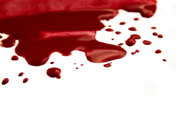 Major Bleeding – how quickly will they bleed to death? | Responder Aid