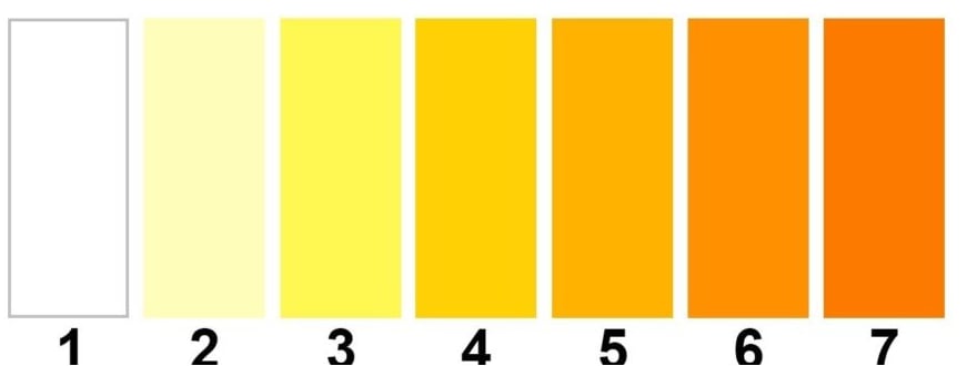 Šlapimo spalvos ir jo reikšmės? | Euromedika