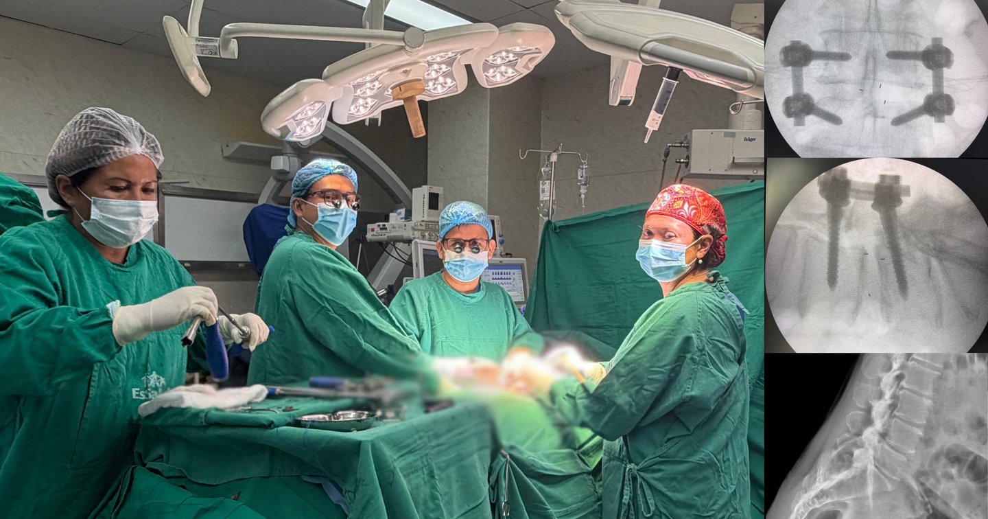 Estabilización con Fijación Transpedicular (FTP) y Fusión Intersomática ...