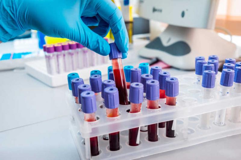 Best Practices for Sample Management in Preclinical and Clinical Trials ...