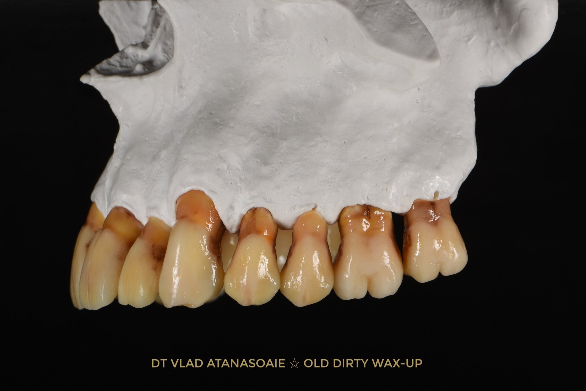 Final Dental Lab | Smile Makeover, Veneers & Full Arch Dentistry ...