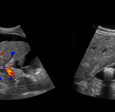 Hands-On Abdominal Ultrasound Training | Clinical Scanning | Keith ...