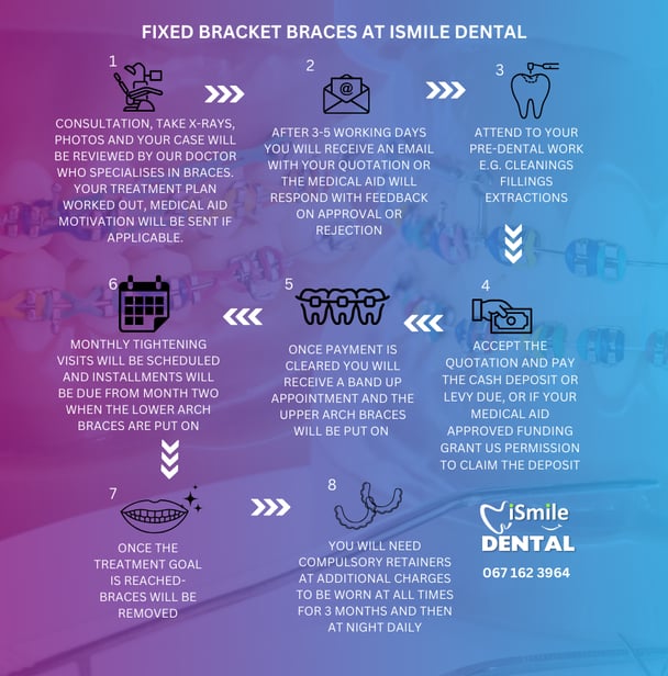 Fixed Bracket Braces A Comprehensive Guide to Getting Braces at iSmile ...