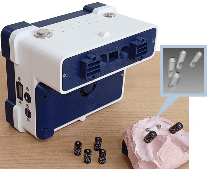 Tupel 3D Dental Implant Scanner | Digital Implant Dentistry | Implant ...