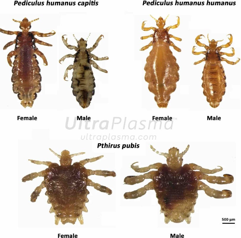 UltraPlasma™ Pediculus Capitis, Corporis, and Phthirus Pubis ...